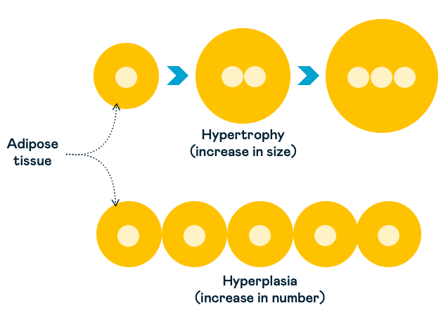 Insulin and the personal fat threshold | Weight loss tips